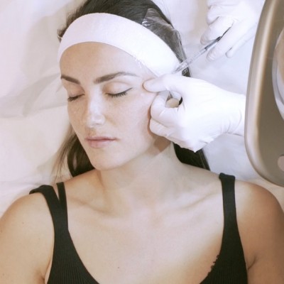 Cheekbones cannula injection | SoftFil Academy
