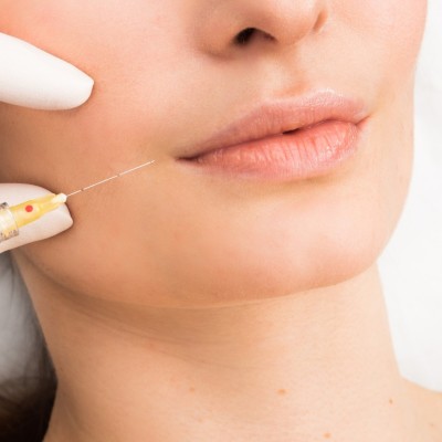 Injection à la canule : Tiers inférieur du visage | SoftFil Academy